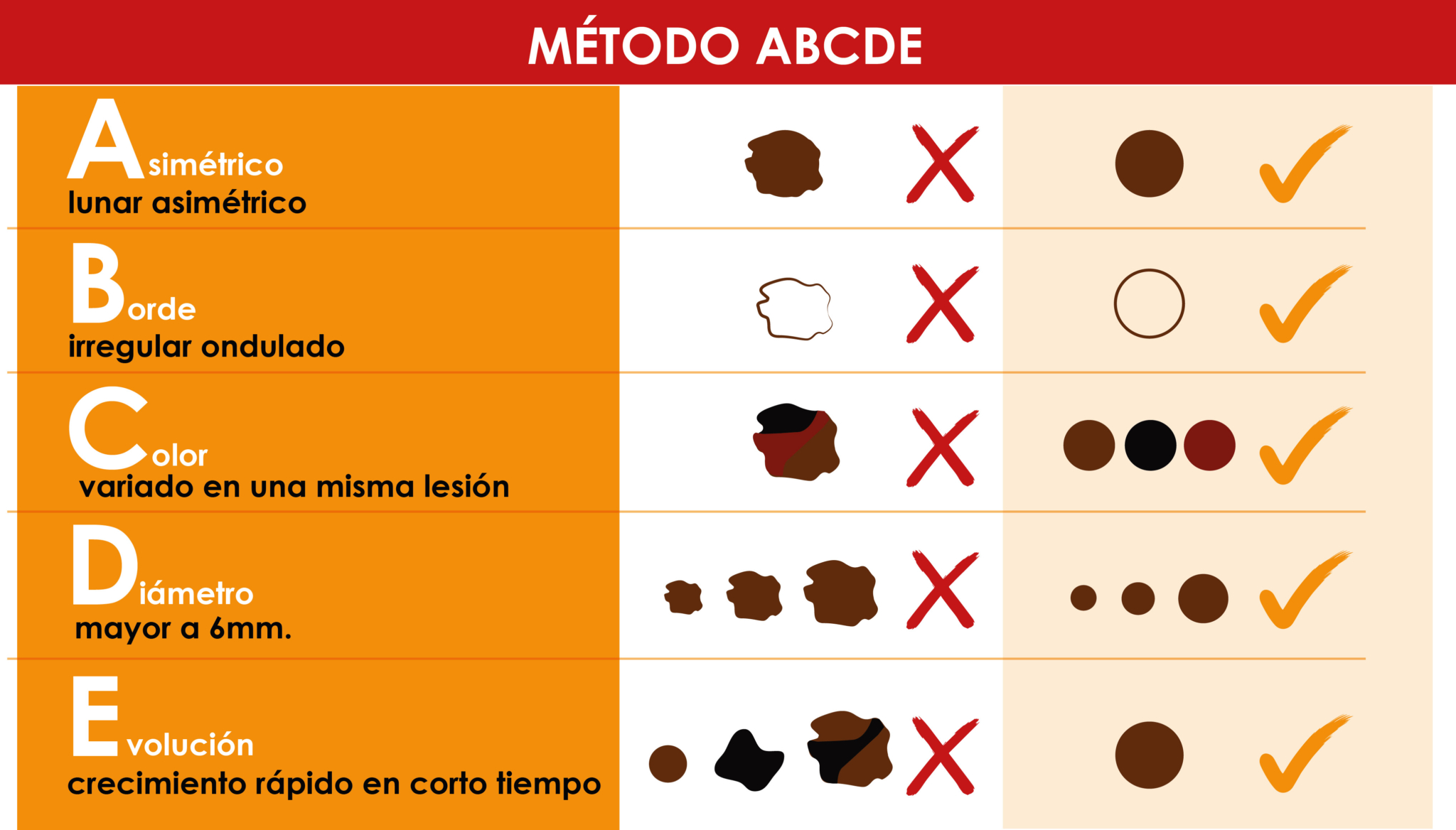 El ABCDE del lunar